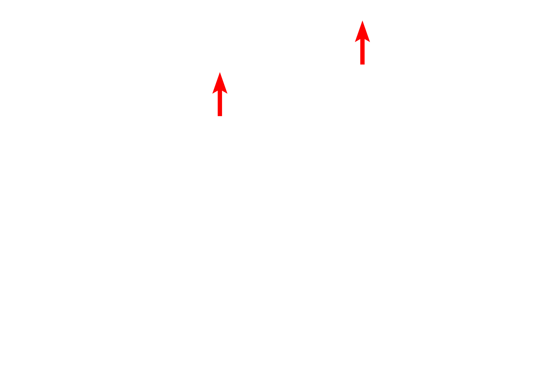 Mitosis light micrographs 3 | Digital Histology