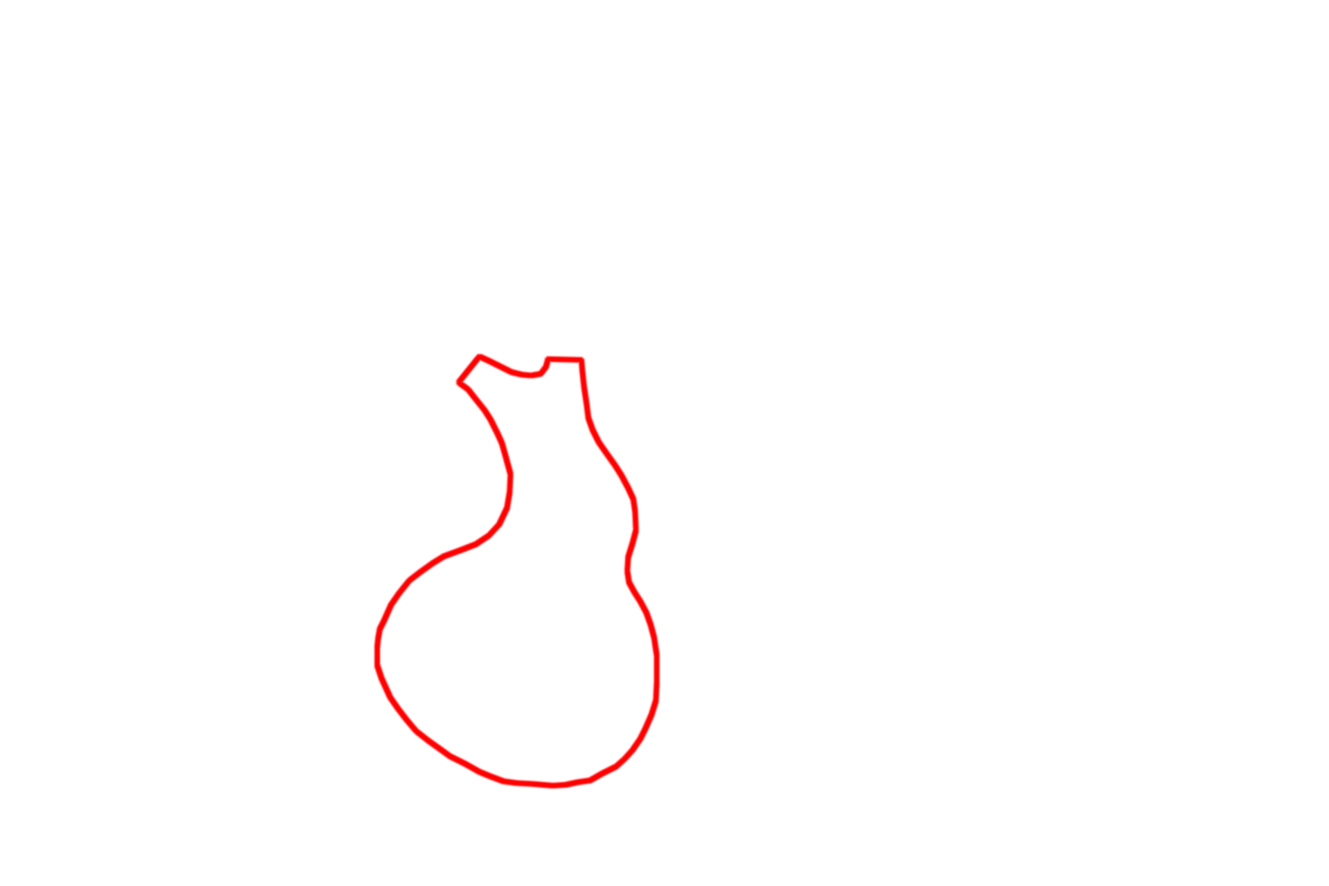 Pituitary 1 | Digital Histology