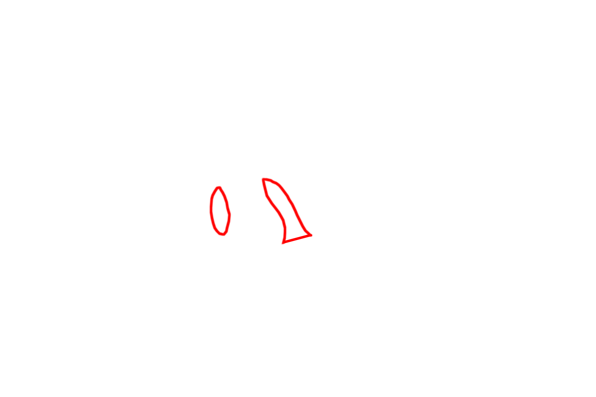Pituitary 1 | Digital Histology
