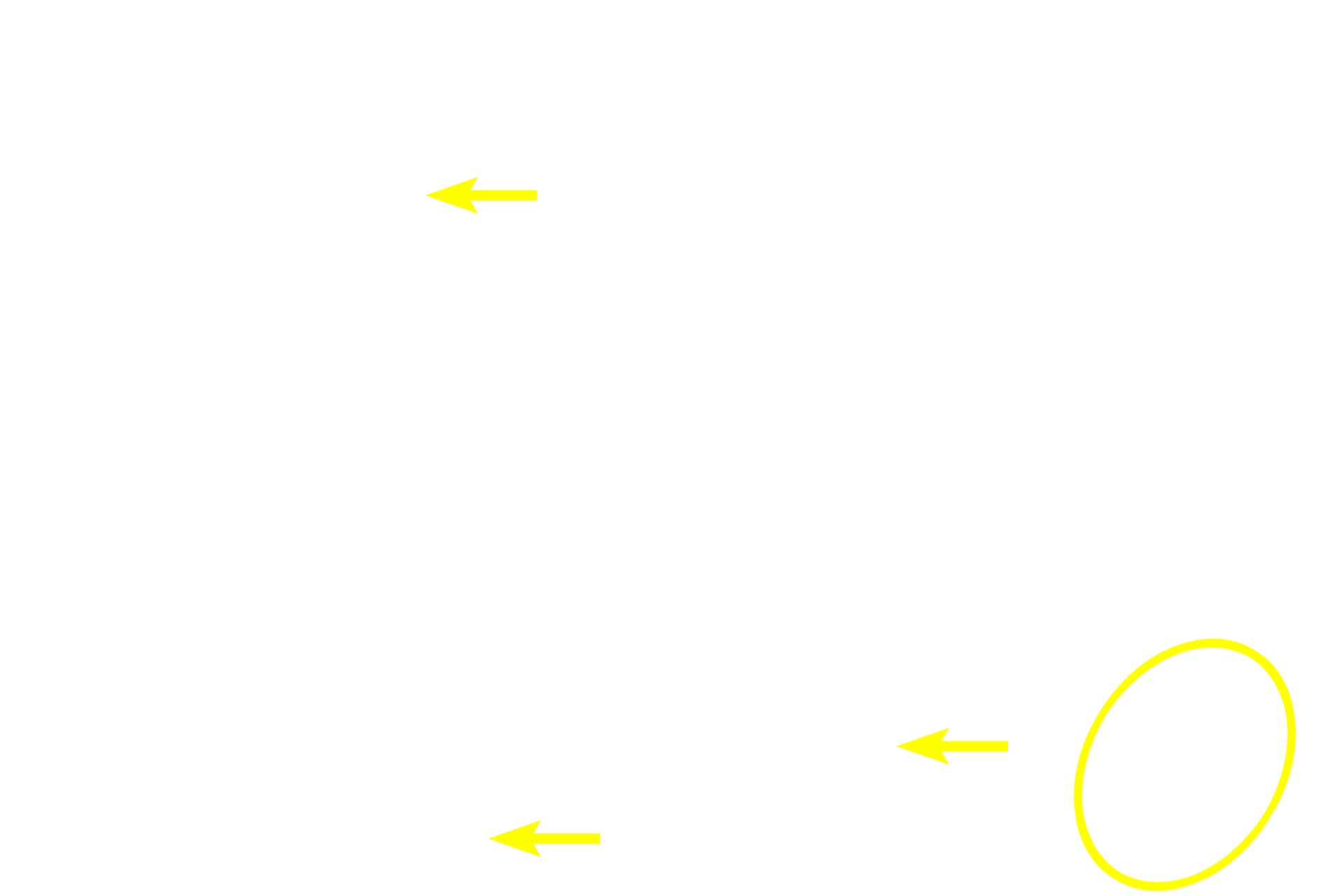 Pituitary 5 | Digital Histology