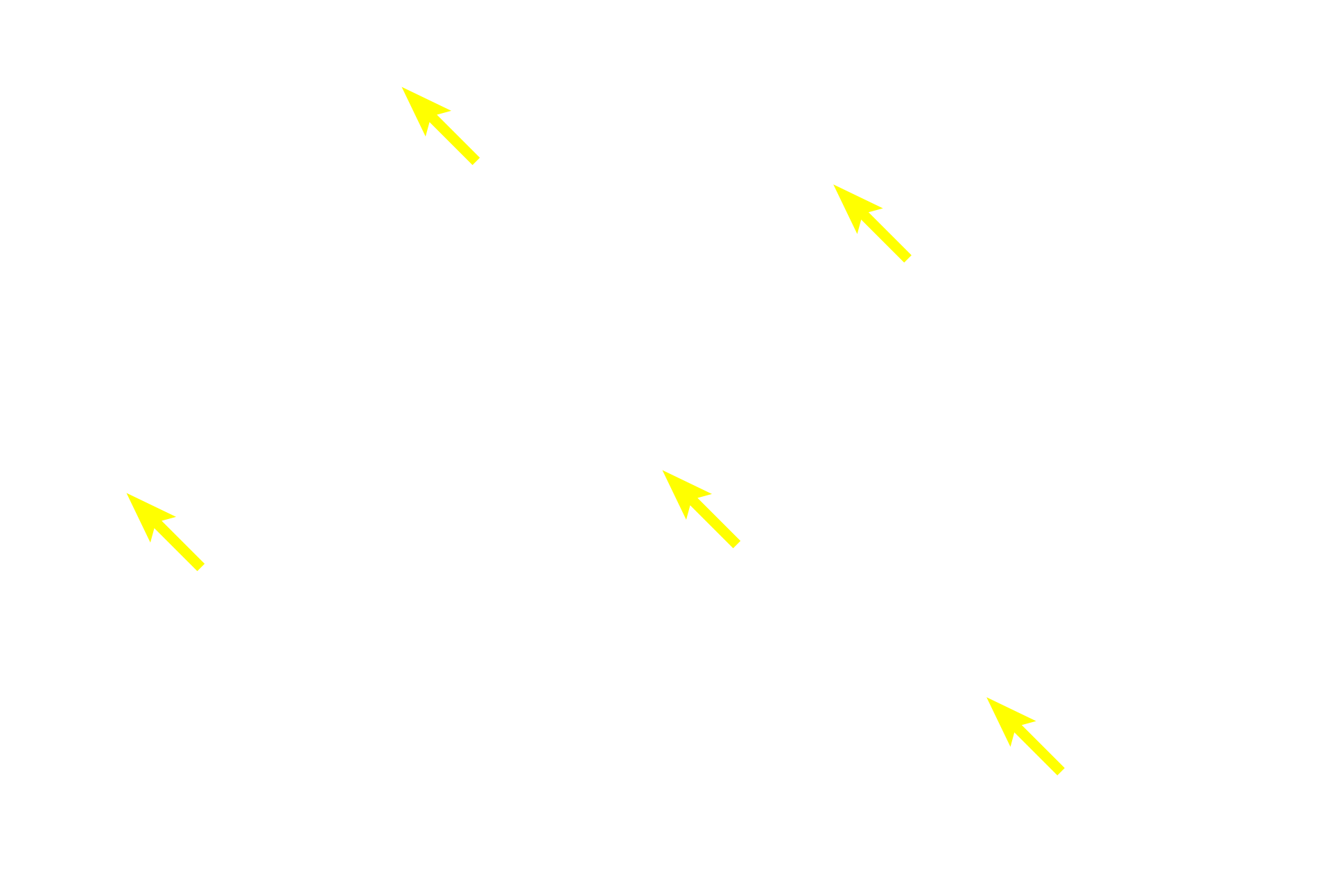 Pancreas 2 | Digital Histology