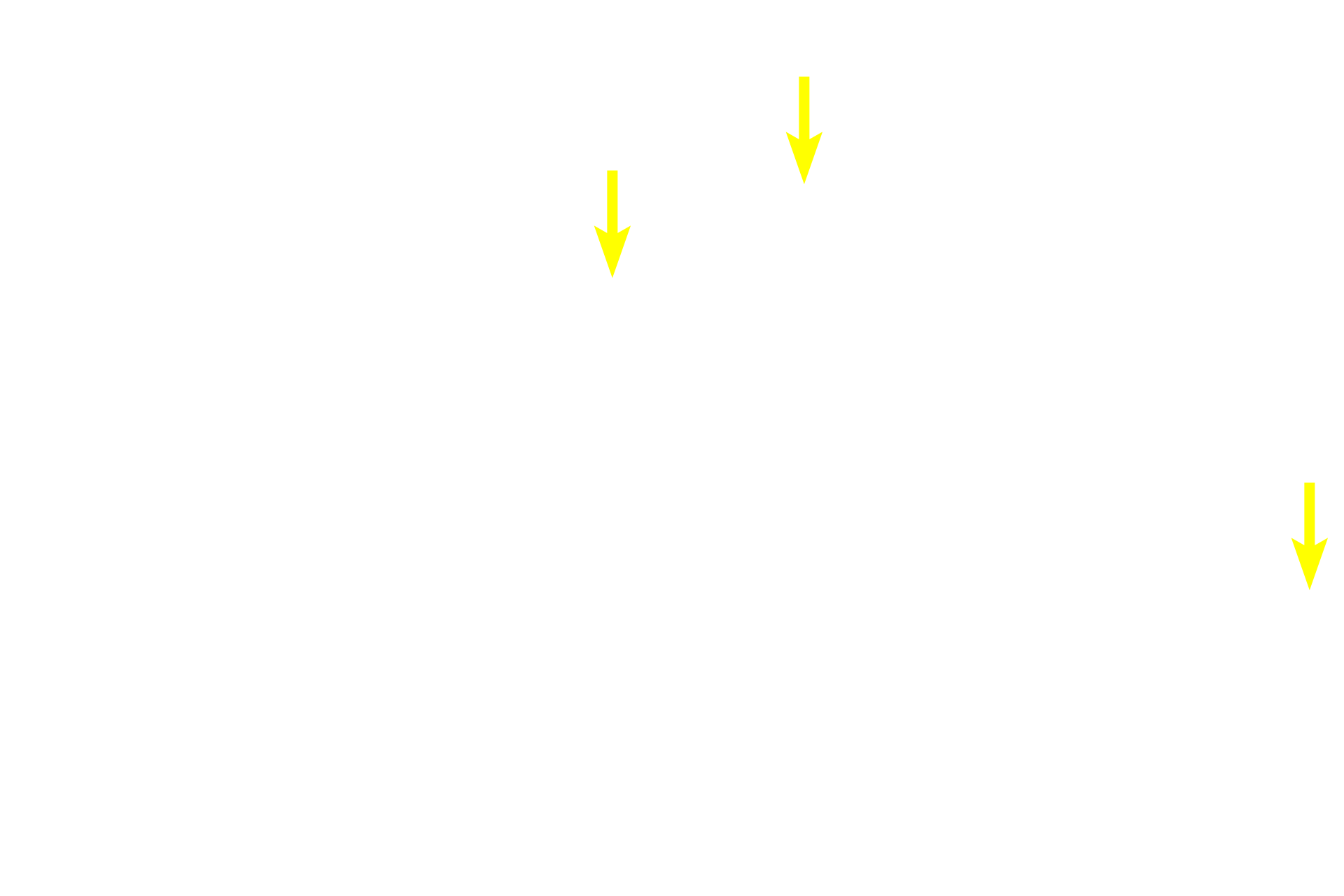 Major salivary glands 8 | Digital Histology